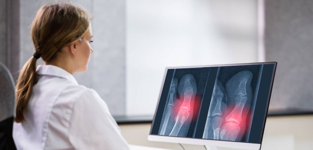 Bone Scan In Goregaon - Medcare Diagnostics